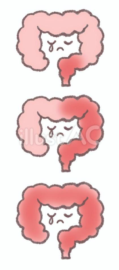 潰瘍性大腸炎イラスト - No: 22839769／無料イラスト/フリー素材なら「イラストAC」