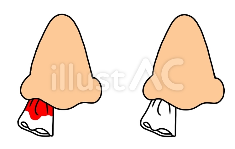 鼻血イラスト - No: 999234｜無料イラスト・フリー素材なら「イラストAC」